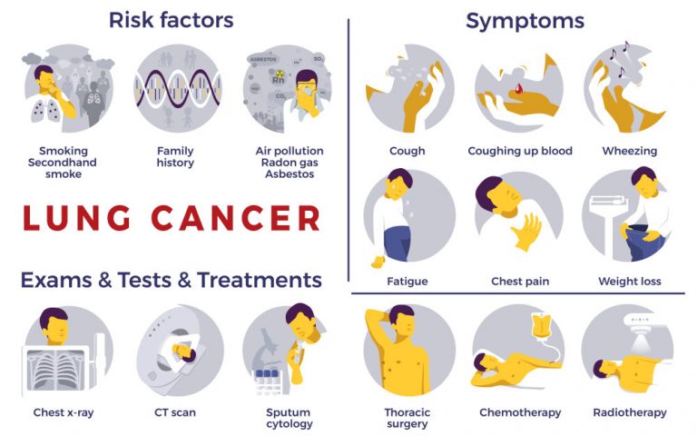 Smoking Causes Lung Cancer: All You Should Know