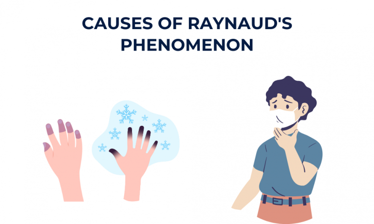 Raynaud's Phenomenon | Causes, Symptoms, And Solutions