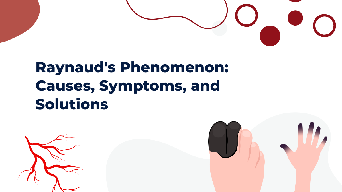 Raynaud's Phenomenon | Causes, Symptoms, And Solutions