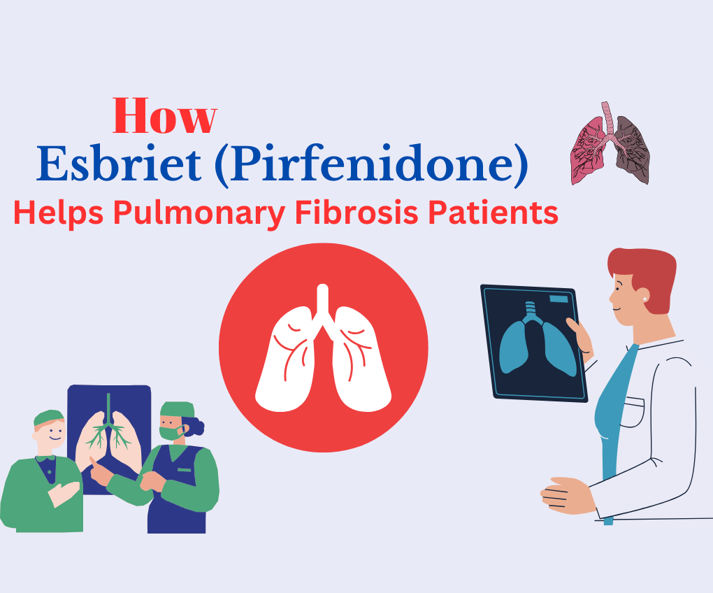 How Esbriet (Pirfenidone) Helps Pulmonary Fibrosis Patients